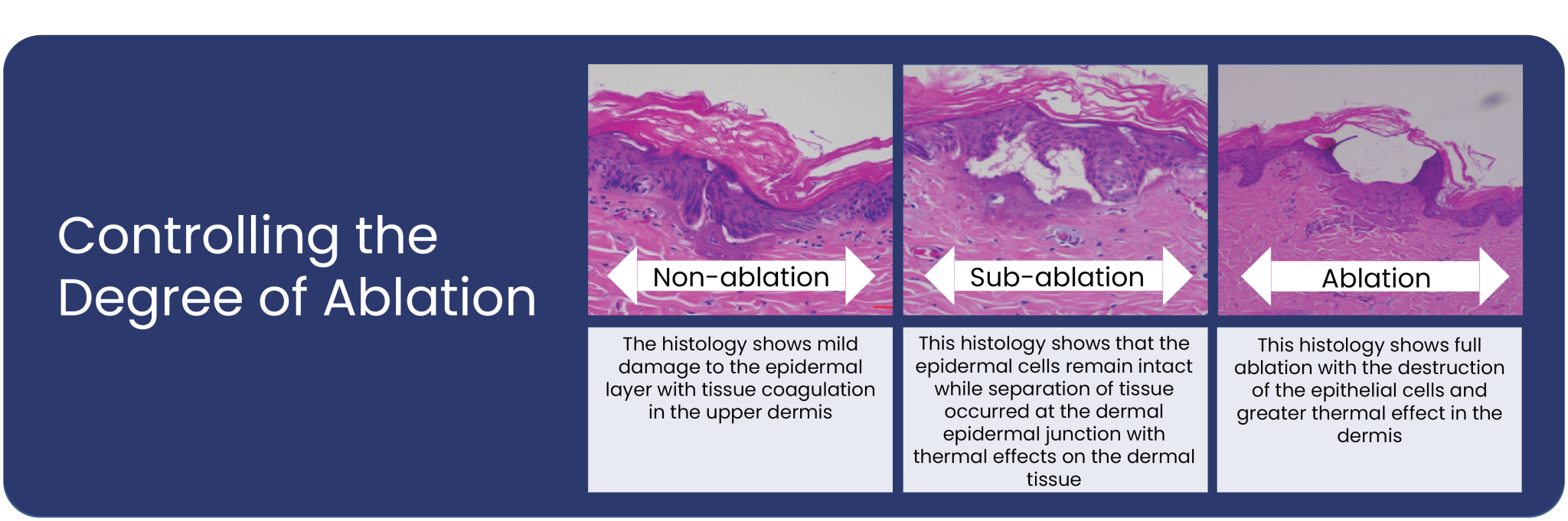 NOUVADerm™ Advanced Laser Skin Resurfacing For All Skin Types